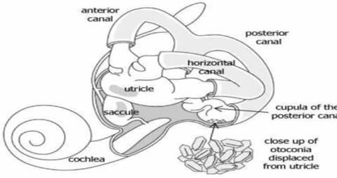 Benign Paroxysmal Positional Vertigo - Ashbourne & Hilton Physiotherapy ...